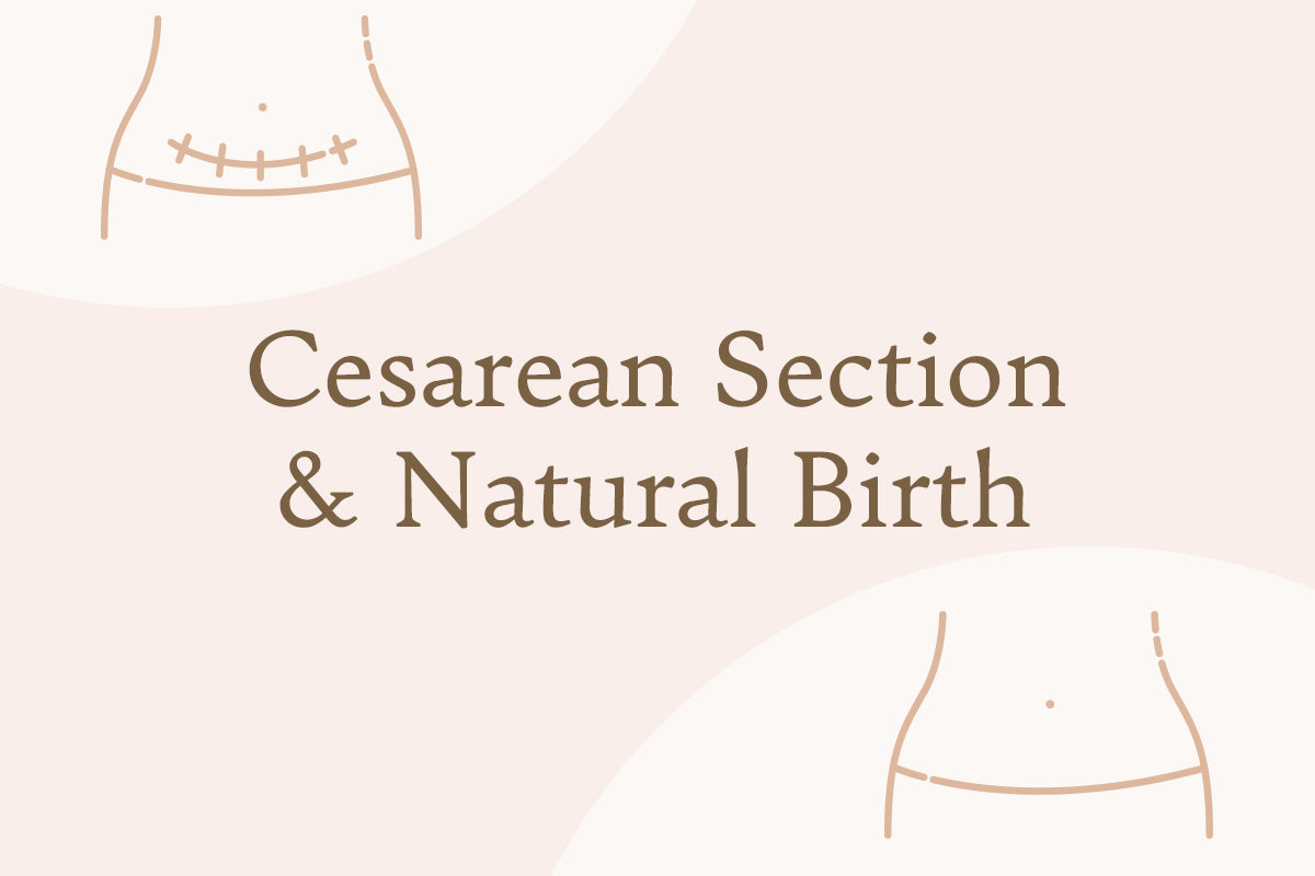 C-section vs. Natural Birth: Understanding Your Options – Sense-U